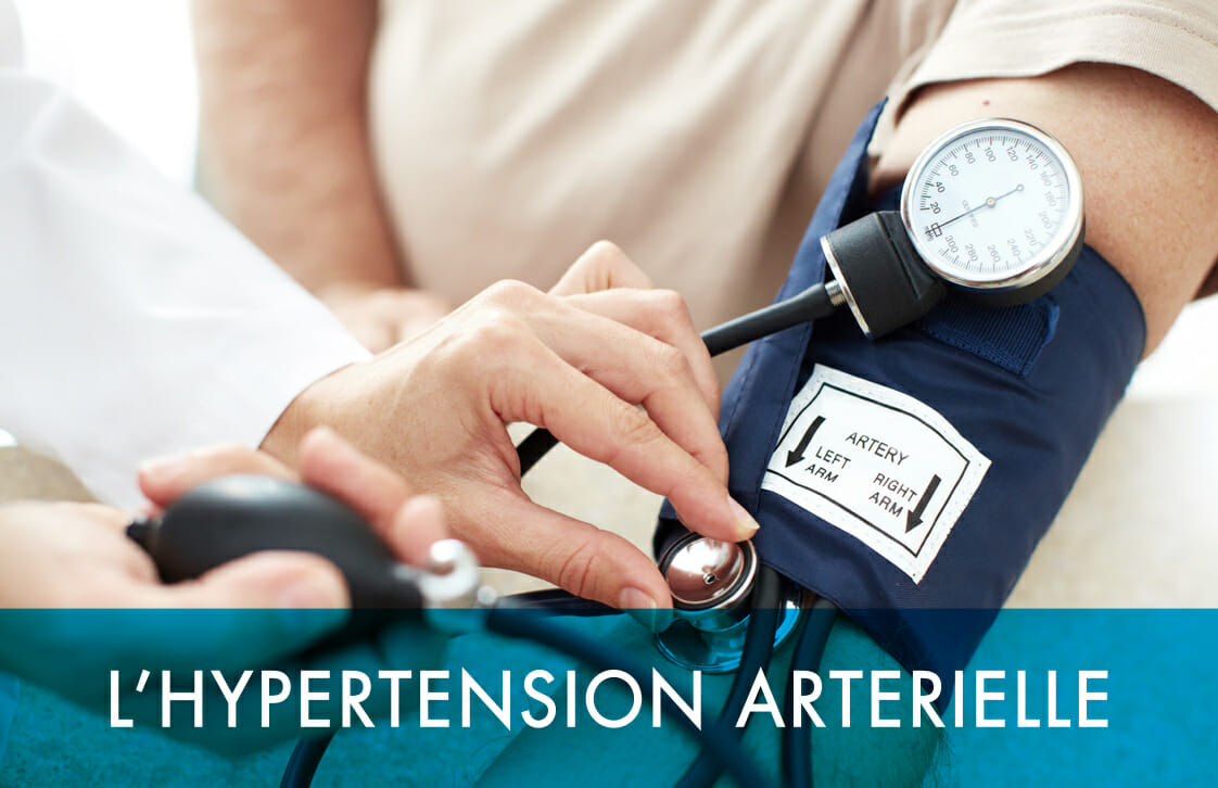 Hypertension artérielle - SSMG