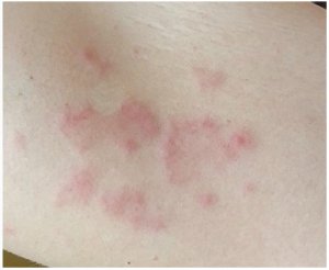 Diagnostic par image – quiz n°8 - SSMG